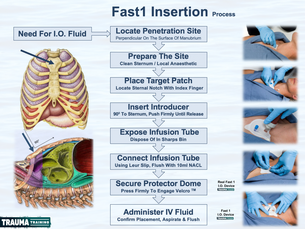 IMCA Diver Medic Technician Refresher (DMT-R) Course - Trauma Training
