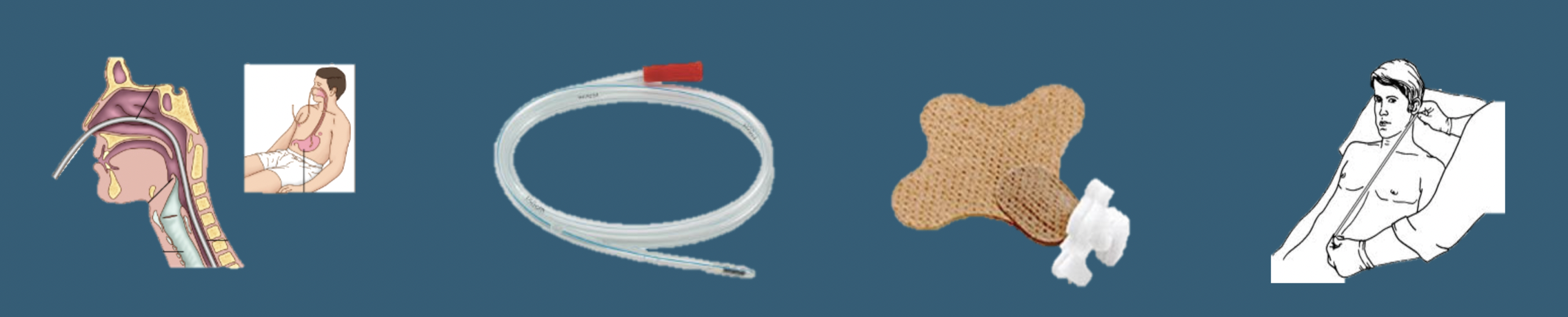 18. Naso-Gastric Tube Insertion - (DMTR) - Trauma Training