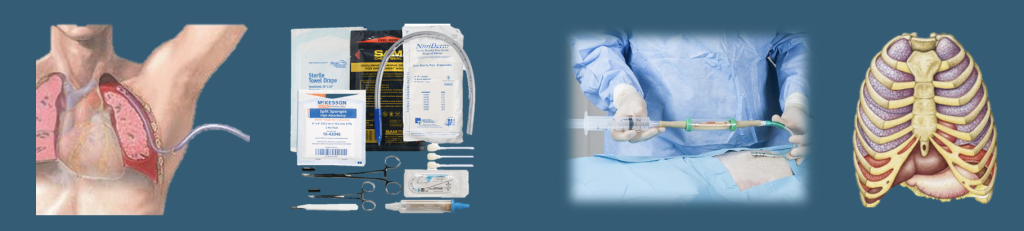 Formal Chest Drainage (Post DMT) - Trauma Training