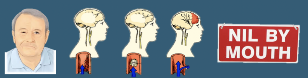 Stroke (CVA) (First Aid) - Trauma Training