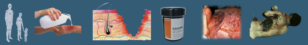 Burns (First Aid) - Trauma Training