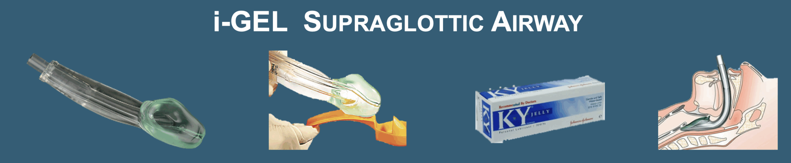 iGEL Intubation - (Post DMT) - Trauma Training