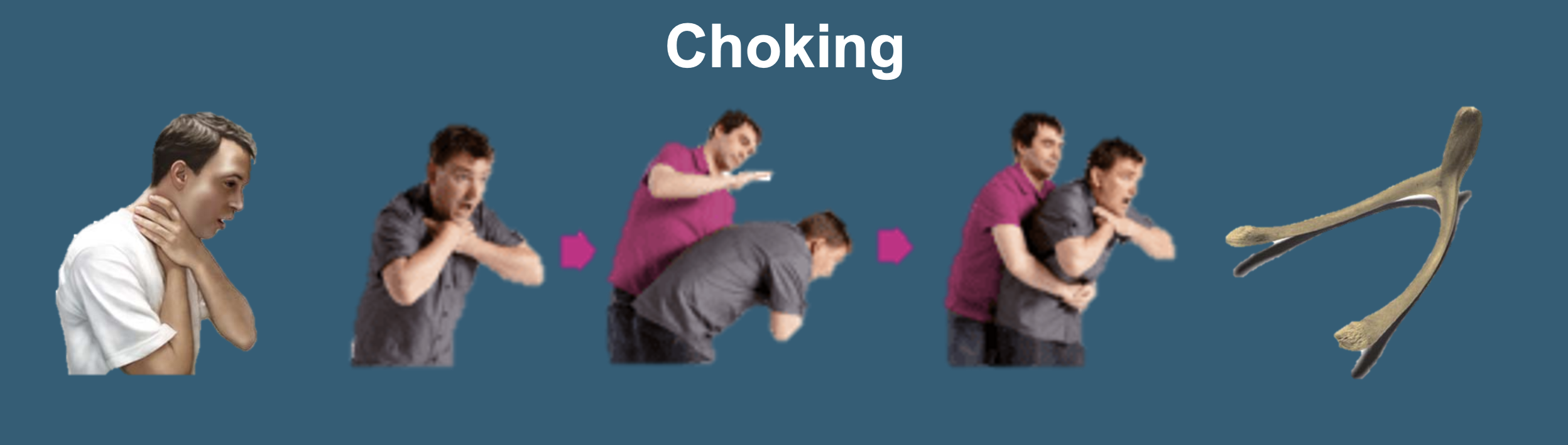 Basic Life Support - (First Aid) - Trauma Training