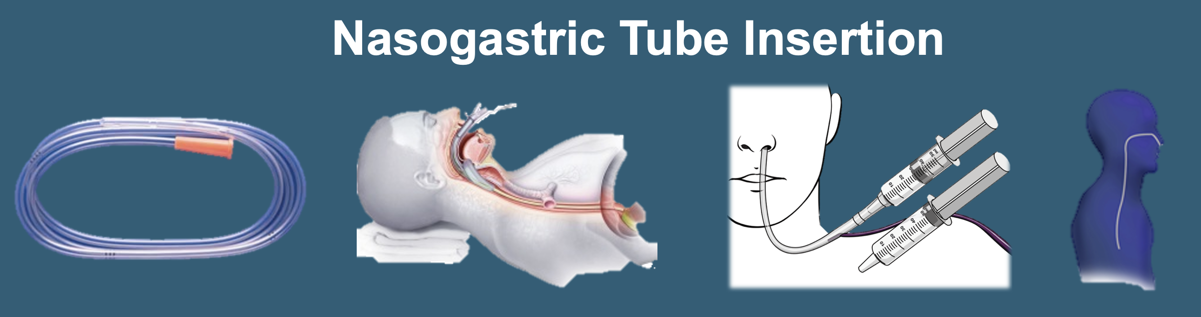19. Naso-Gastric Tube Insertion - (DMTR) - Trauma Training