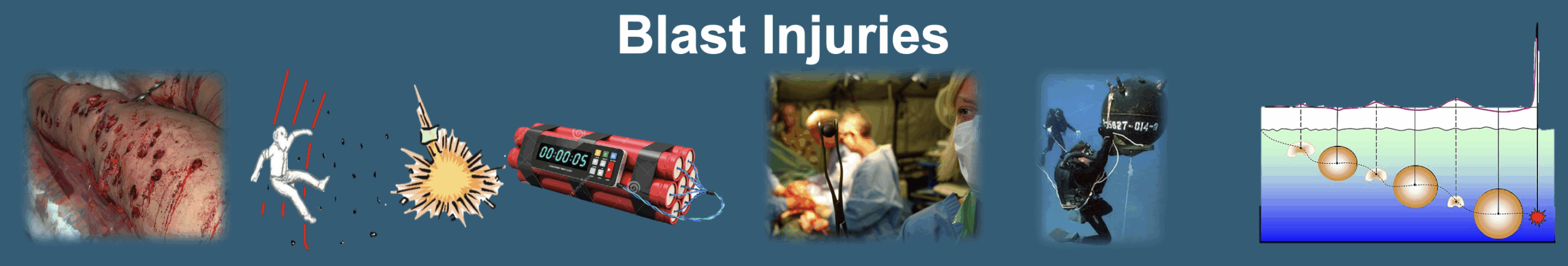 Blast Injuries - (DMT) - Trauma Training