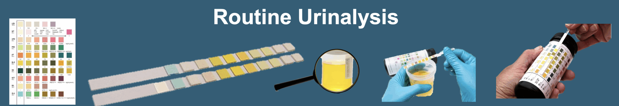 Urinalysis Dip-Stick Testing - (DMT) - Trauma Training