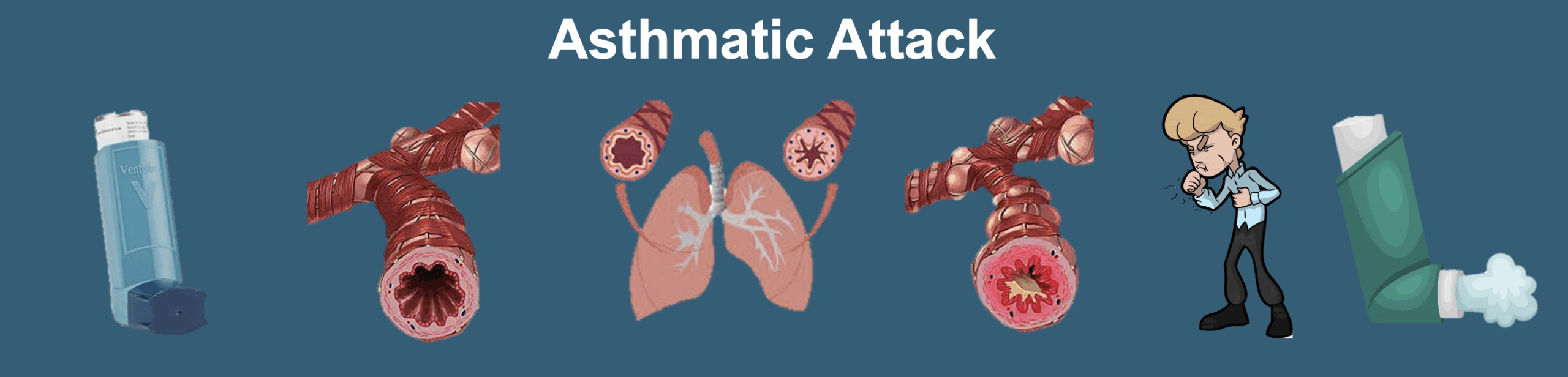 Asthma - (First Aid) - Trauma Training