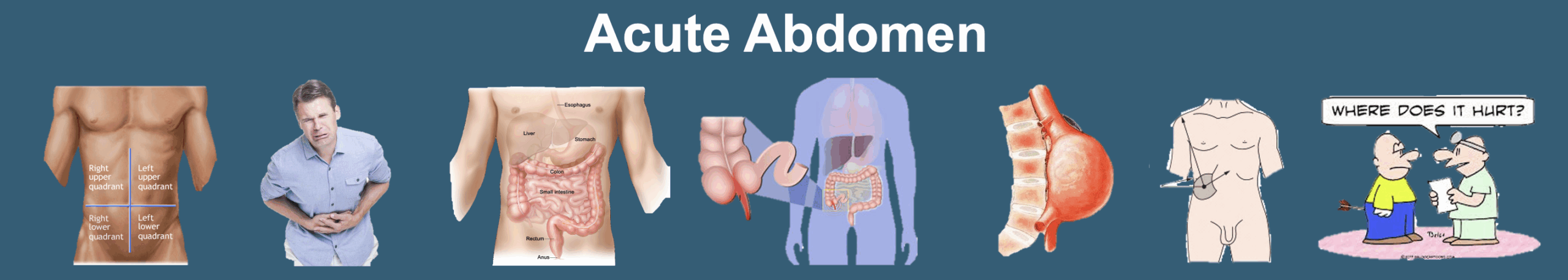 Acute Abdomen - (DMT) - Trauma Training
