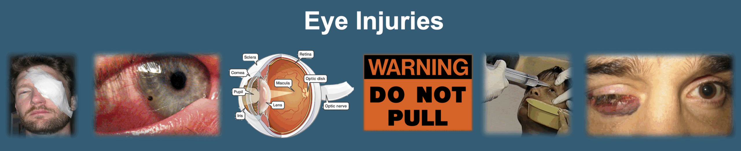 Eye Injuries - (DMT) - Trauma Training
